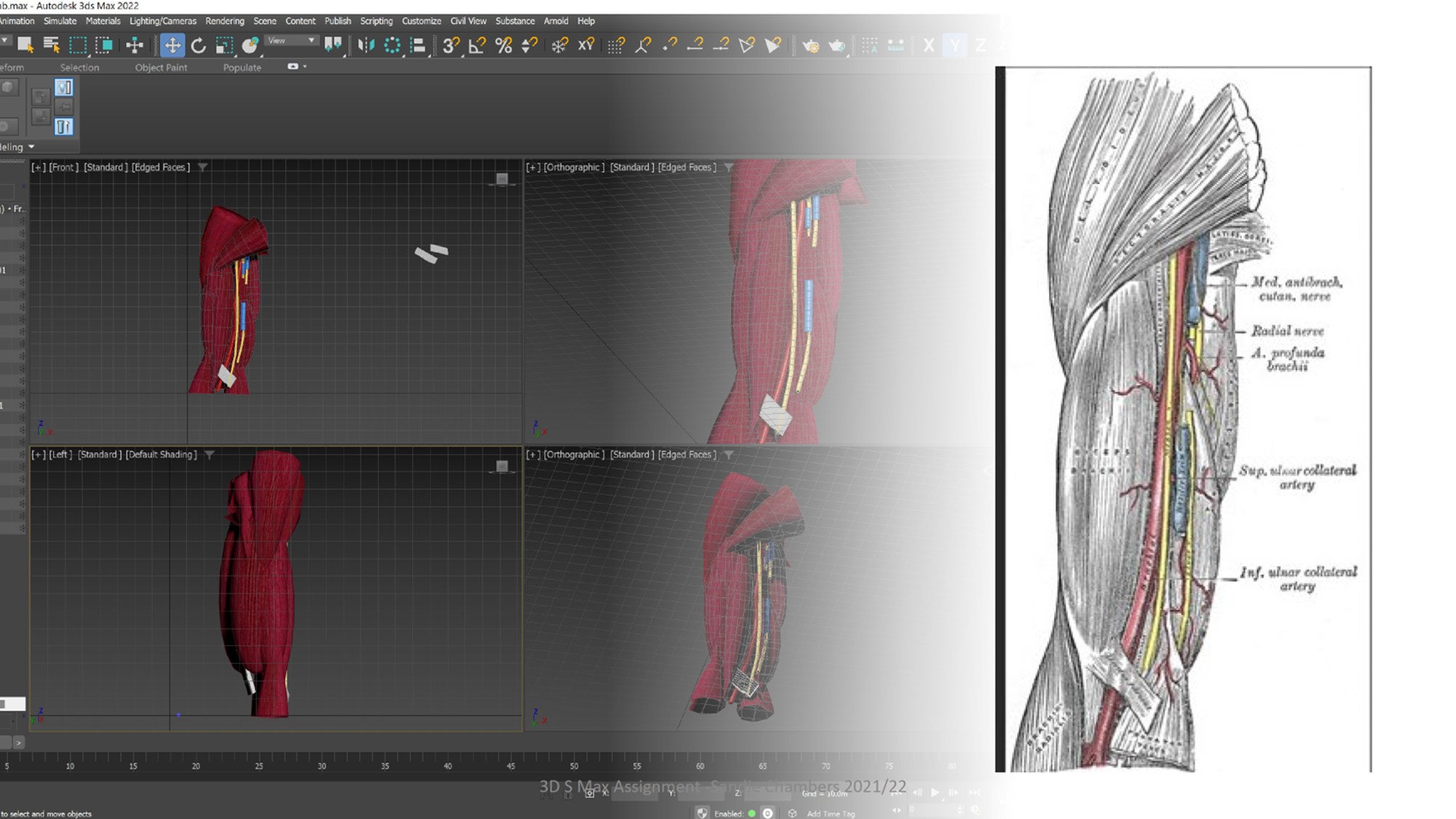 MSc Medical Visualisation & Human Anatomy – GSA Postgrad Showcase 2022